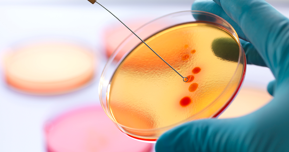 Key Differences in Microbial Formulation Applications: Foliar Sprays vs ...